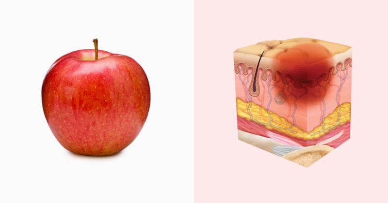 Helping hospitals prioritize preventive wound care - Medline Newsroom