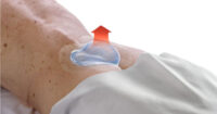 Medline introduces first-of-its-kind transparent wound dressing aiding ...